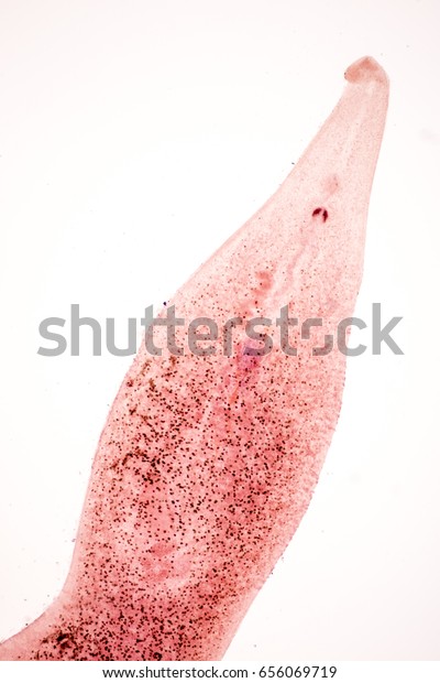 Monogenean Parasite Under Microscope View Stock Photo 656069719 ...