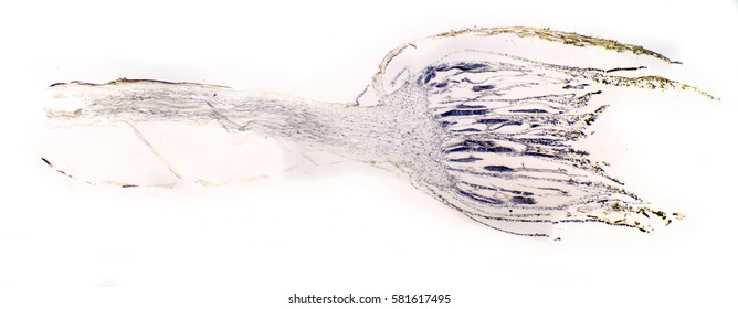 Moss Antheridia Under Microscope Stock Photo 581617495 | Shutterstock