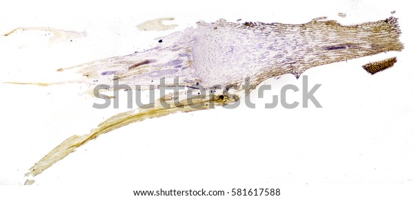 Moss Archegonia Under Microscope Stock Photo 581617588 | Shutterstock