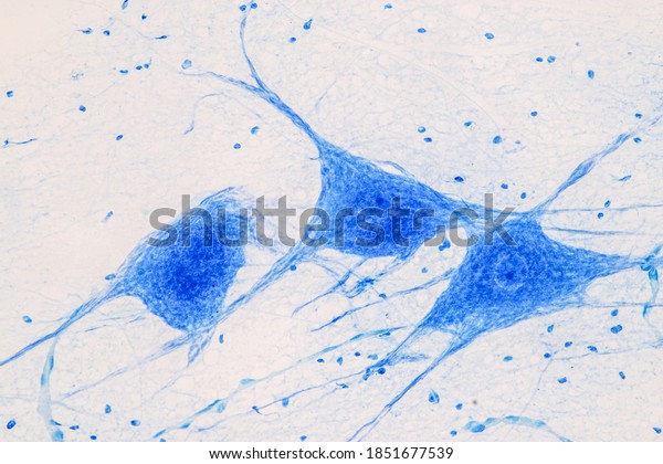 Motor Neuron Under Microscope Lab Stock Photo 1851677539 | Shutterstock