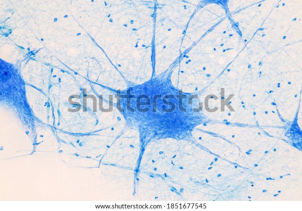 132 Nissl body 图片、库存照片和矢量图 | Shutterstock