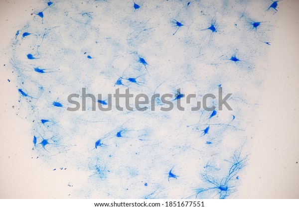 Motor Neuron Under Microscope Lab Stock Photo 1851677551 | Shutterstock