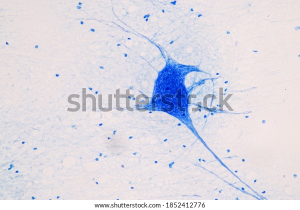 Motor Neuron Under Microscope Lab Stock Photo 1852412776 | Shutterstock