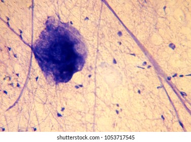 88 Interneuron 图片、库存照片和矢量图 | Shutterstock