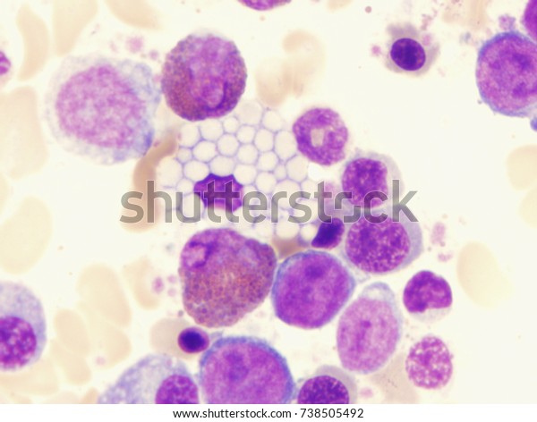 Mott Cell Stock Photo (Edit Now) 738505492