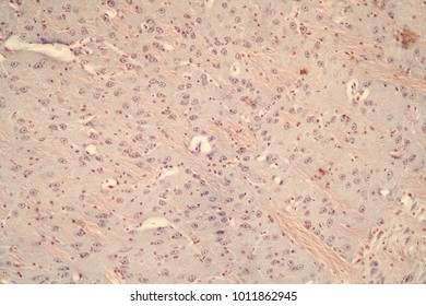 Mouse Brain Tissue Under Microscope 100 Foto de stock 1011862945 ...