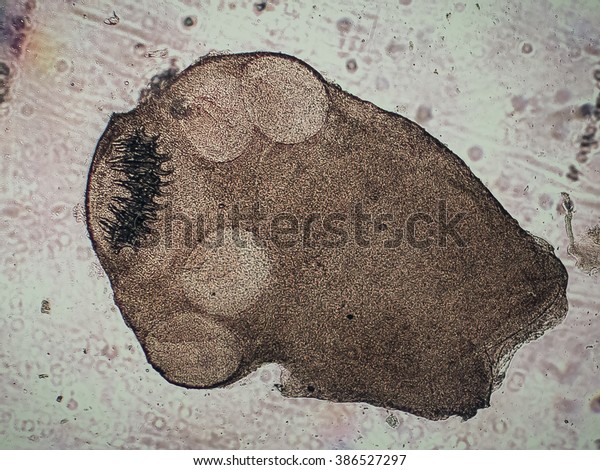 Multiceps Multiceps Protoscoleces Stock Photo 386527297 | Shutterstock