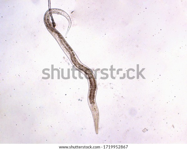 Nematode Worm Water Under Microscope Stock Photo 1719952867 | Shutterstock