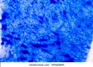 Nerve Cell Under Microscope Abstract Blue库存照片399683890 | Shutterstock