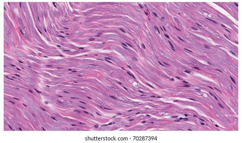 Nerve Under Microscope库存照片70287394 | Shutterstock