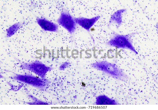 Neurons cells from the brain under the microscope view