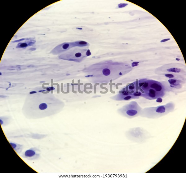 Normal Squamous Epithelial Cells Cervical Human Foto Stok 1930793981 ...