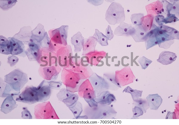 Normal Squamous Epithelial Cells Cervical Human Stock Photo 700504270 ...