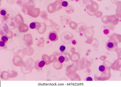 Abnormal Red Blood Cells Blood Smear库存照片1050978308 | Shutterstock