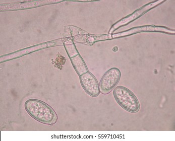 36 Oidium spores Images, Stock Photos & Vectors | Shutterstock
