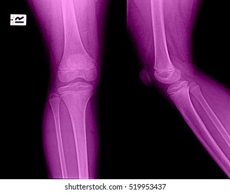 Scanogram Lower Limb Medical Background Stock Illustration 1196735944