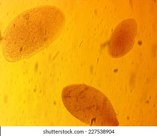 Opalina Ranarum Permanent Slide Plate Under Foto Stok 227538904 ...