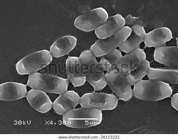 Original Scanning Electron Microscope Images Fungi Stock Photo (Edit ...