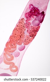 Parasite On Slide Under Microscope View Stock Photo 537240022 ...
