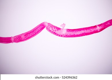 Parasite Under Microscope Stock Photo (Edit Now) 524396362