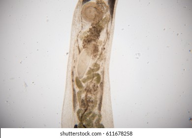 Egg Parasite Under Microscope Stock Photo (Edit Now) 1409572517