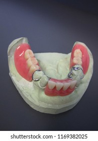 Partial Denture Model Stock Photo 1169382025 | Shutterstock