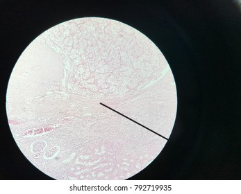 Moniezia Hexacanth Embryo Under Microscope Stock Photo 1408605875 ...