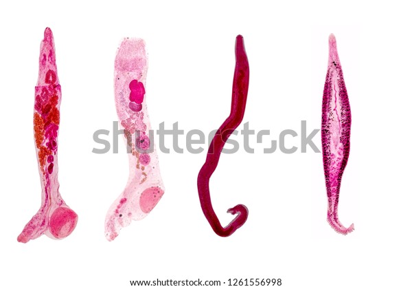Patterns Backgrounds Parasitic Study Anatomical Pathology Stock Photo ...