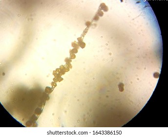 51 Peanuts under microscope Görseli, Stok Fotoğraflar ve Vektörler ...