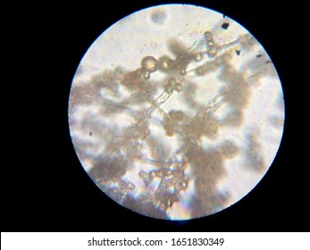 51 Peanuts under microscope Görseli, Stok Fotoğraflar ve Vektörler ...