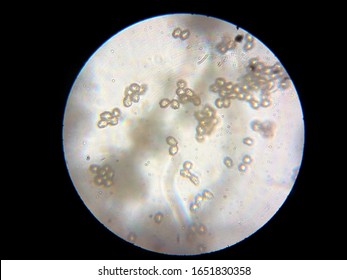 51 Peanuts under microscope Görseli, Stok Fotoğraflar ve Vektörler ...