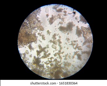 51 Peanuts under microscope Görseli, Stok Fotoğraflar ve Vektörler ...