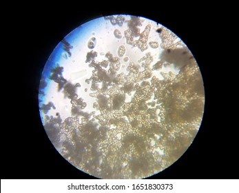 51 Peanuts under microscope Görseli, Stok Fotoğraflar ve Vektörler ...