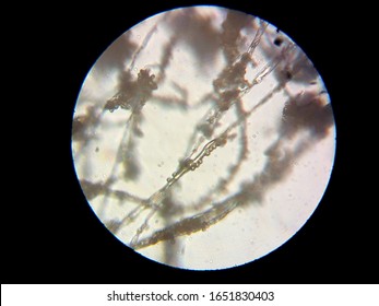 51 Peanuts under microscope Görseli, Stok Fotoğraflar ve Vektörler ...