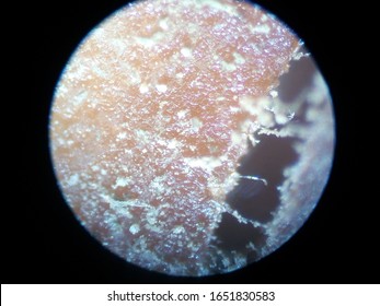 51 Peanuts under microscope Görseli, Stok Fotoğraflar ve Vektörler ...