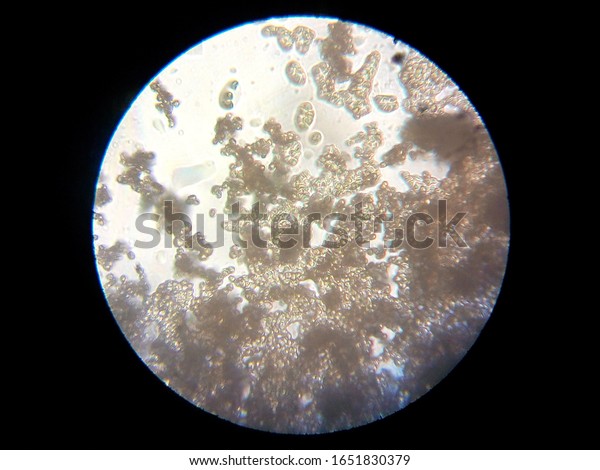 Peanuts Under Microscope Under Increase Spoiled Stock Photo 1651830379 ...