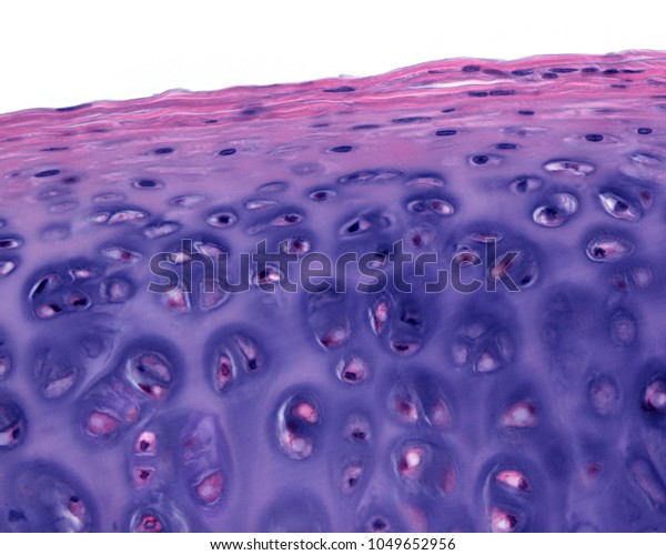 Perichondrium Layer Dense Irregular Connective Tissue Stock Photo (Edit ...