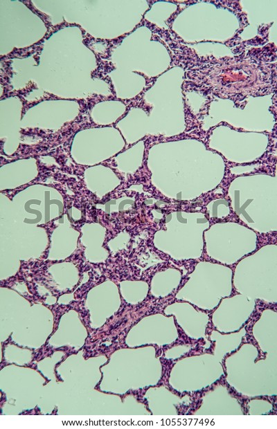 Pig Lung Under Microscope Stock Photo 1055377496 | Shutterstock