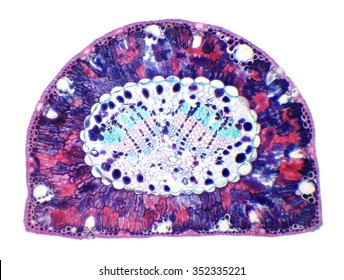 Pine Leaf Transverse Section Microscope Photo Stock Photo 794324506 ...