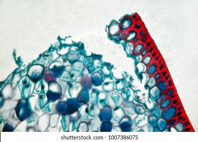 Pine Needle Under Microscope Cross Section Stock Photo 1007386075 ...