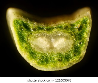 Pine Needles Under Microscope Background Pinus Stock Photo 121603078 ...