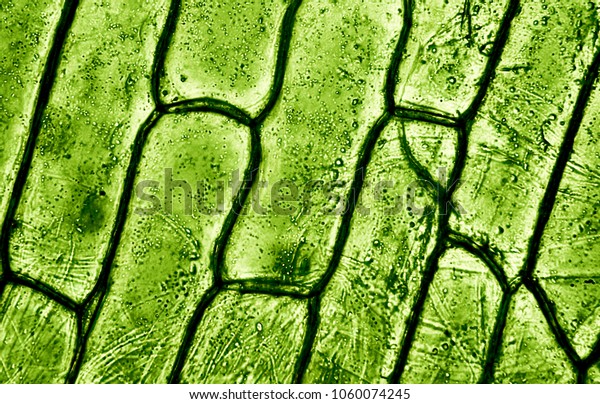 Xylem Tissue Under Microscope