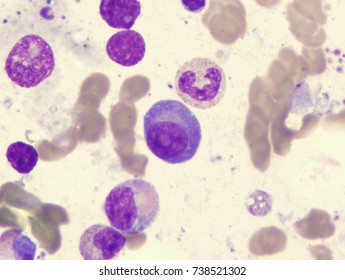 Plasmablasts: afbeeldingen, stockfoto‘s en vectoren | Shutterstock