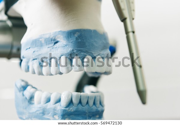 Plaster Cast Teeth Removable Partial Denture Stock Photo 569472130 ...