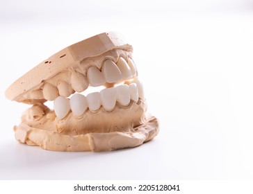 Plaster Casts Teeth On White Background Stock Photo 2205128041 ...
