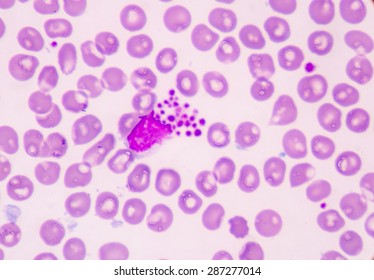 162 Platelet clumping Images, Stock Photos & Vectors | Shutterstock