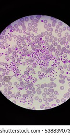 Platelet Clumping 스톡 사진 538839187 | Shutterstock