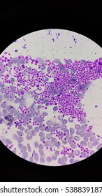 162 Platelet clumping Images, Stock Photos & Vectors | Shutterstock