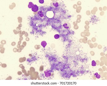 162 Platelet clumping Images, Stock Photos & Vectors | Shutterstock