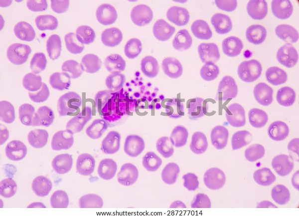 Platelet Clumping Stock Photo 287277014 | Shutterstock